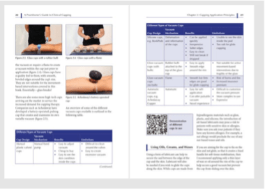 A Practitioner’s Guide to Clinical Cupping – Agence Schweiger
